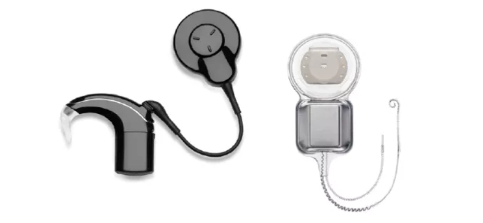 Difference between hearing aids and cochlear implant - Good But Not ...